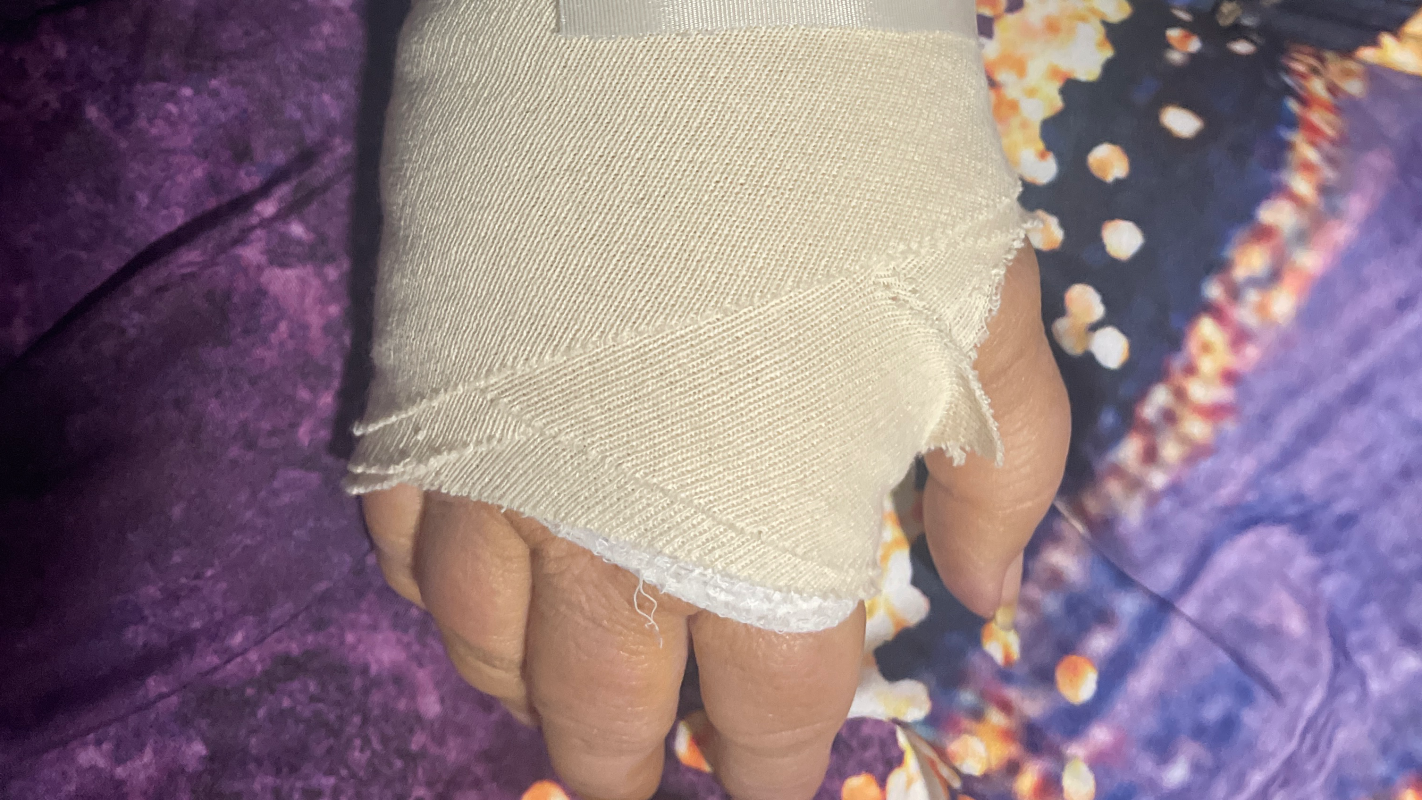 Give A Hand | Wrist surgery