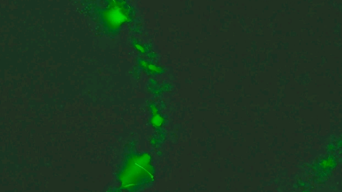 Give A Hand | Please help me get life changing medical intervention for ...