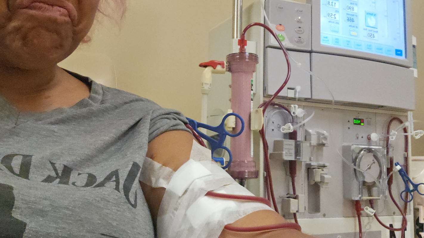 Give A Hand | Bridget's kidney transplant